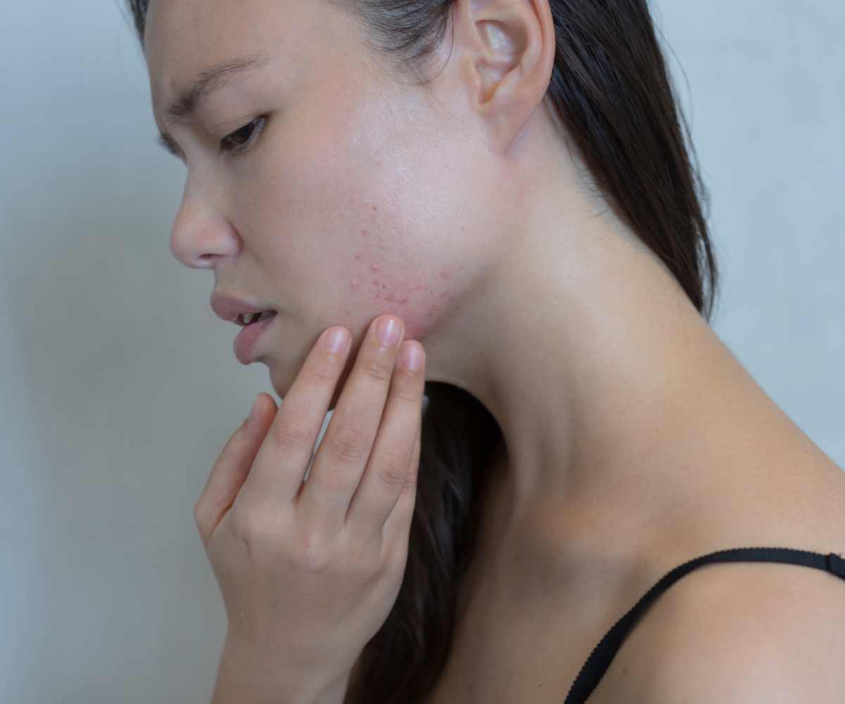 How to prevent those tiny skin coloured bumps? – Upgrad'd Laboratories